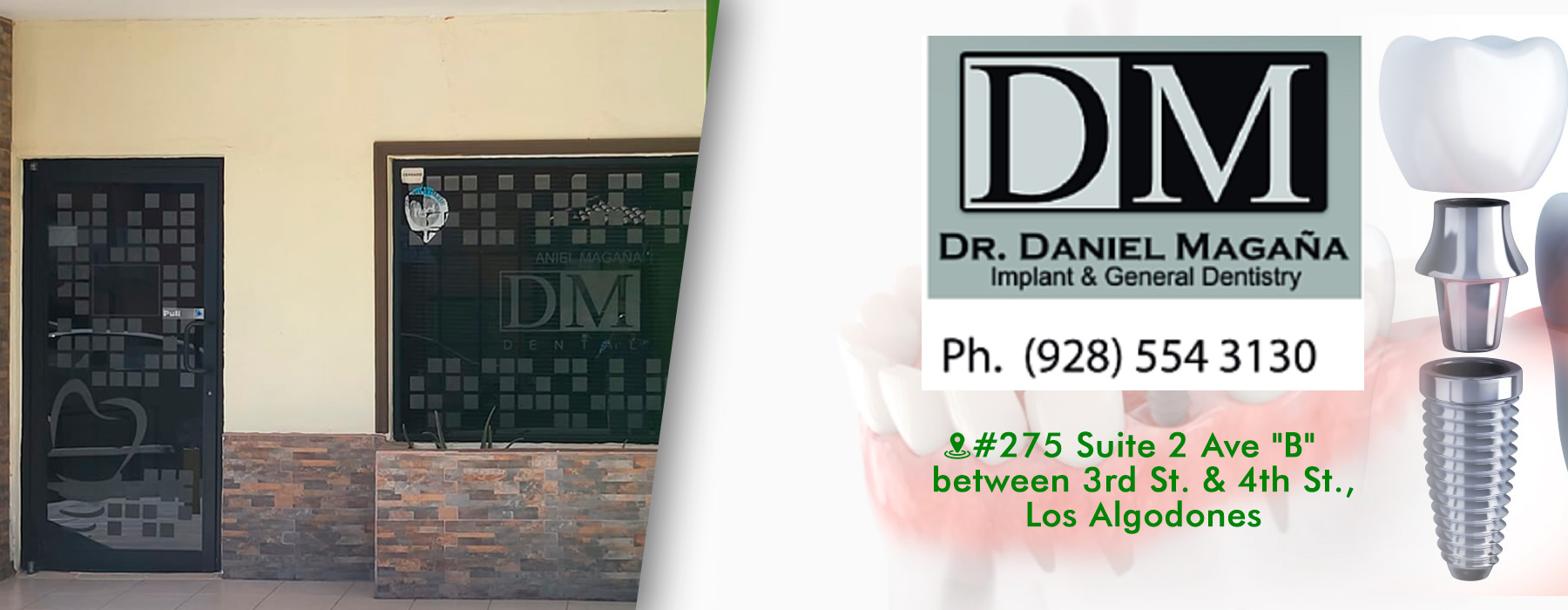 Dentists in Los Algodones, Molar City, Mexico.